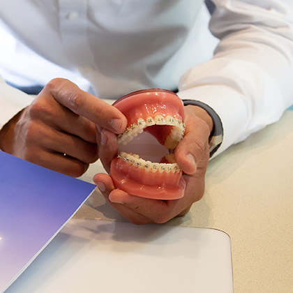 Metal Braces - Burlington ON | Hurd Tomson Orthodontics